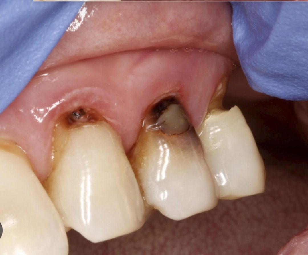 Biological Dentistry, Cavities and the AO Scan - AO Scan Global